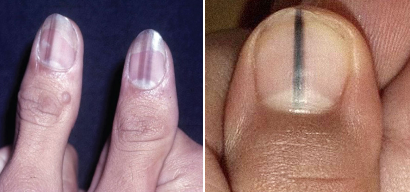 Medical Dermatology – Park Slope Dermatology | Brooklyn NYC